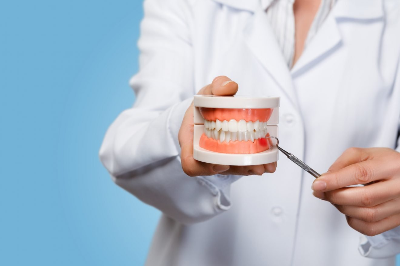 Periodontia - Clínica Autran Odontologia